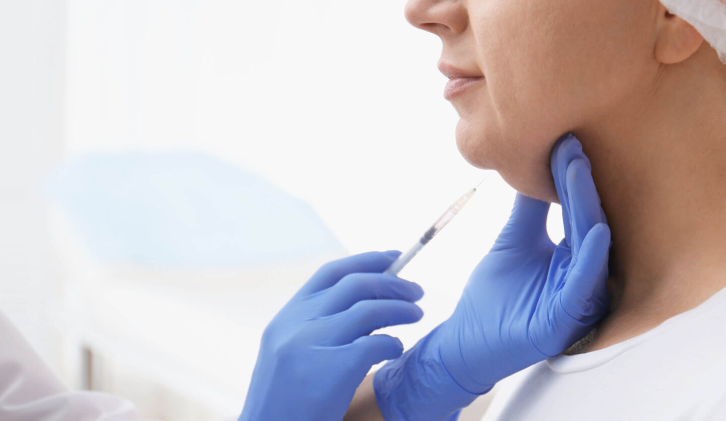 Doppelkinn Entfernen Mit Spritze – Dermacare Wien